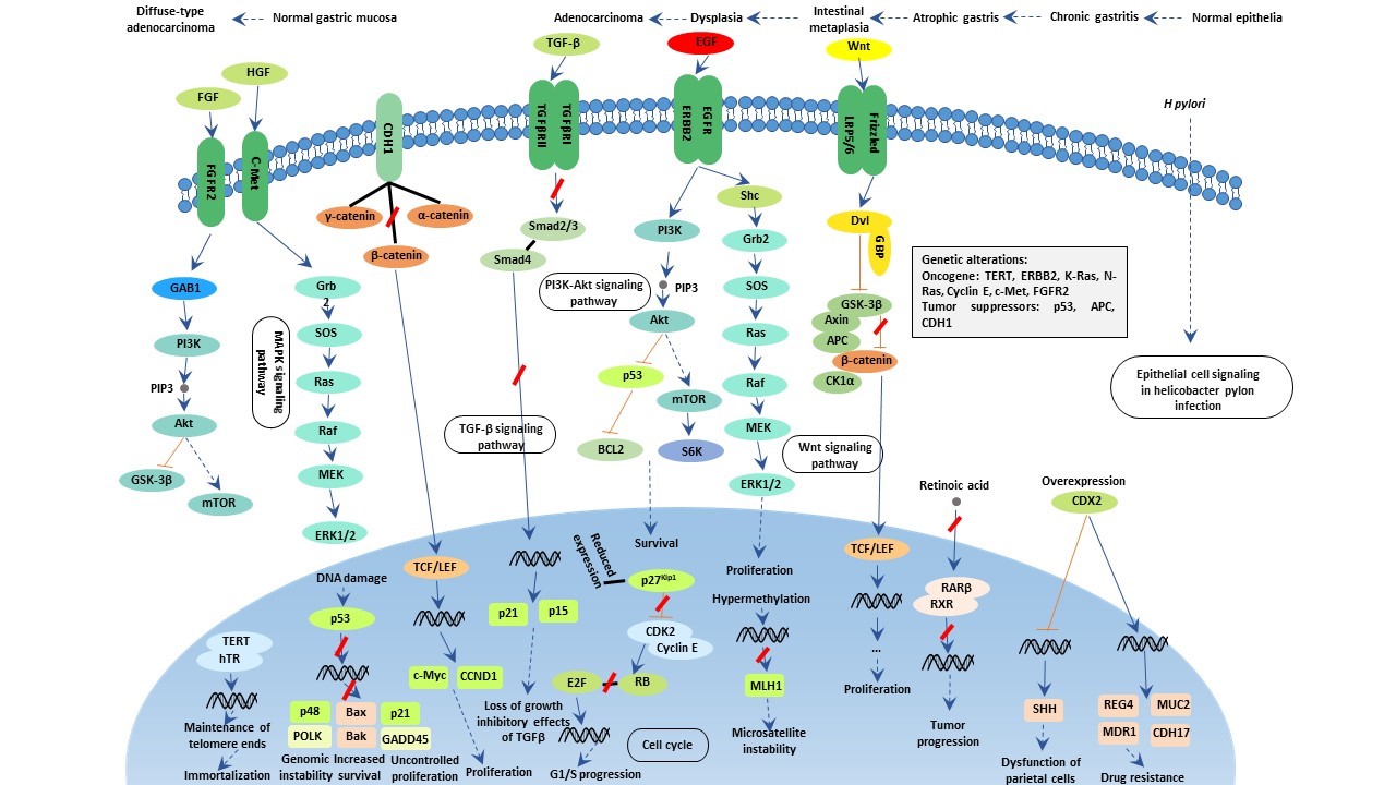 The Overview of Gastric Cancer
