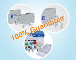 Antibodies, Protein, ELISA Kits, Clone and Reagents for Life Science- Cusabio