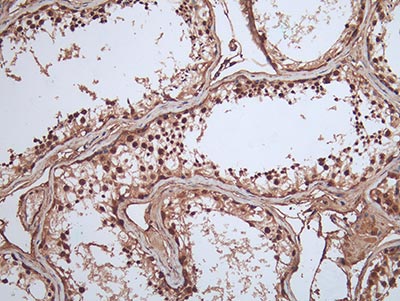 Antibodies, Protein, ELISA Kits, Clone and Reagents for Life Science- Cusabio